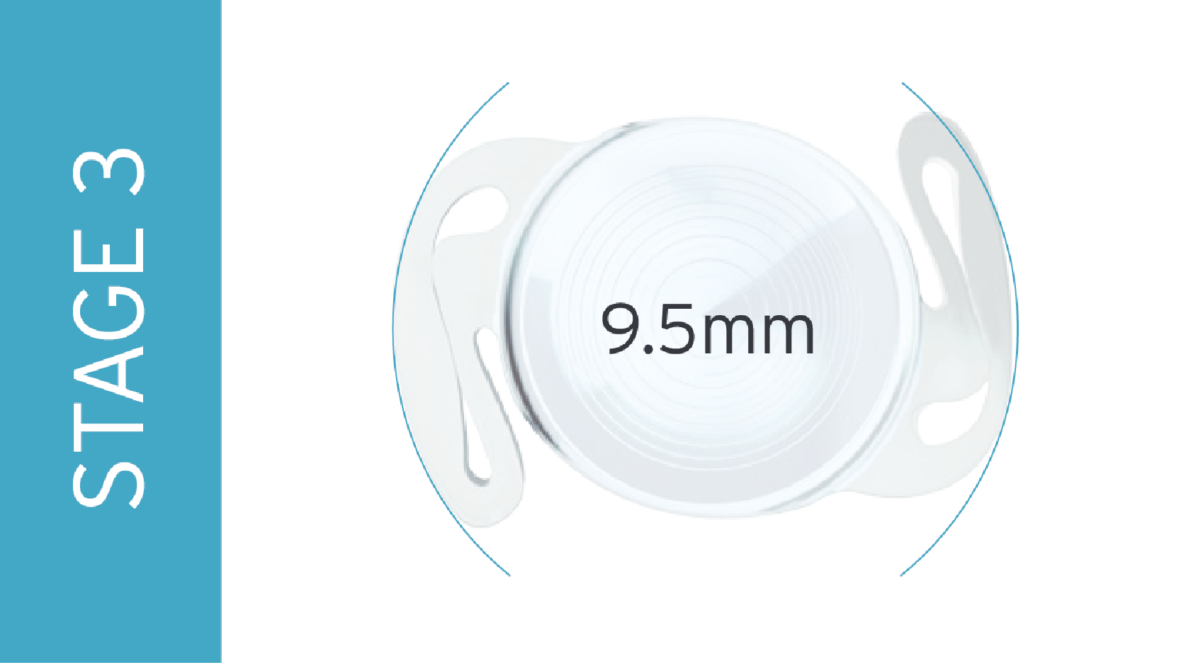 RayOne Trifocal fully preloaded IOL system | Rayner