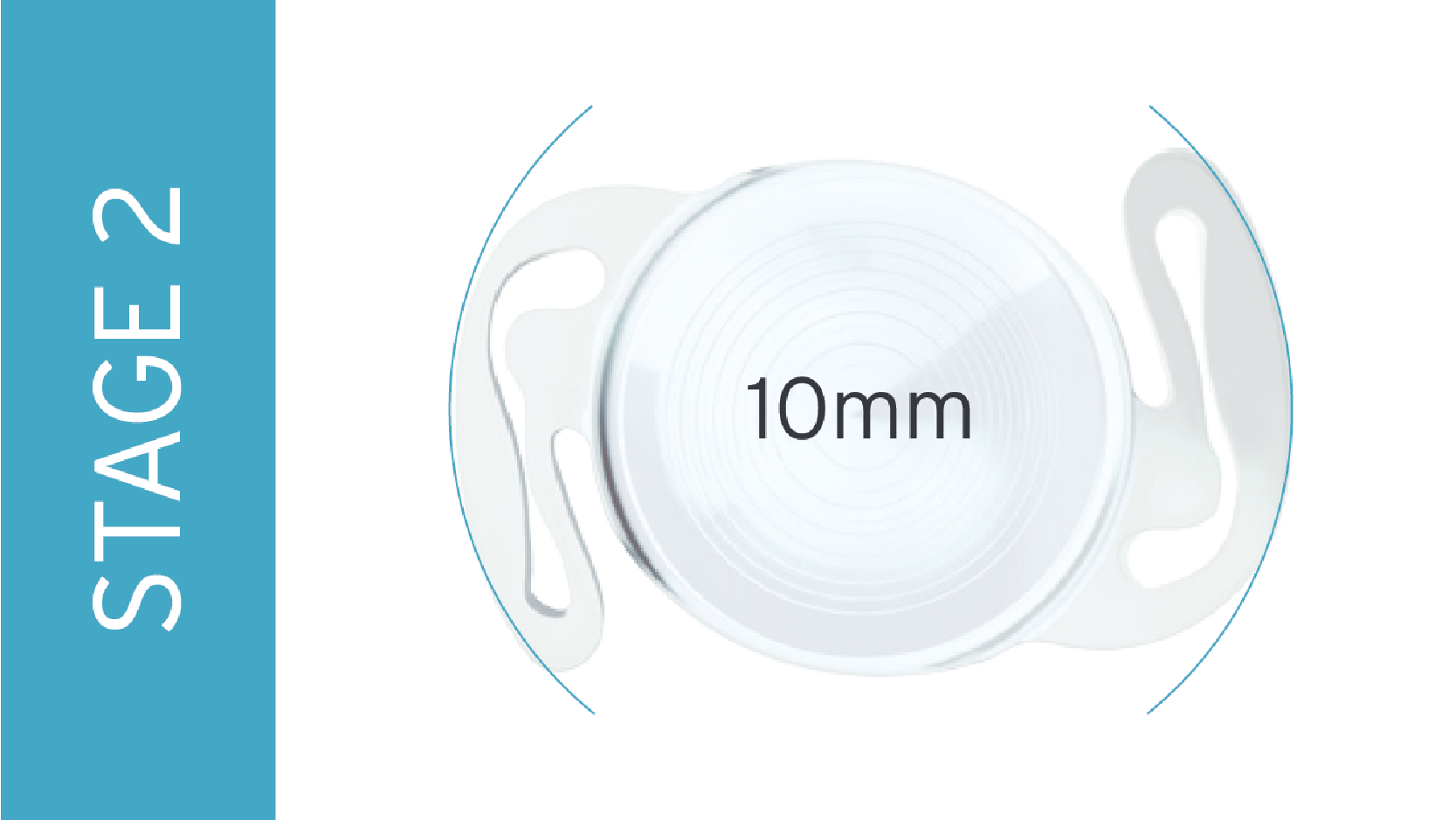 RayOne Trifocal fully preloaded IOL system | Rayner